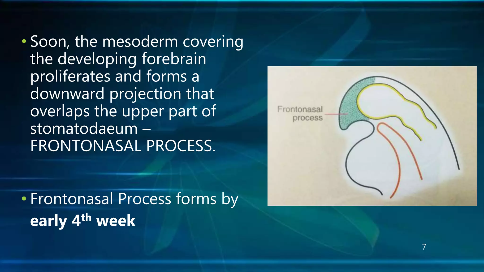 Cleft Lip and Cleft Palate | PPTX | Ear, Nose and Throat Conditions ...