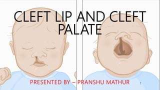 Cleft Lip and Cleft Palate | PPTX