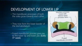 Cleft Lip and Cleft Palate | PPTX