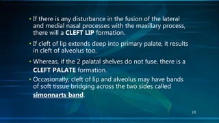 Cleft Lip and Cleft Palate | PPTX