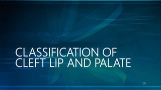 Cleft Lip and Cleft Palate | PPTX