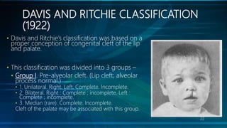 Cleft Lip and Cleft Palate | PPTX