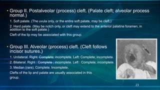 Cleft Lip and Cleft Palate | PPTX