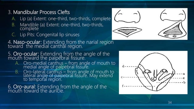 Cleft Lip and Cleft Palate | PPTX | Ear, Nose and Throat Conditions ...