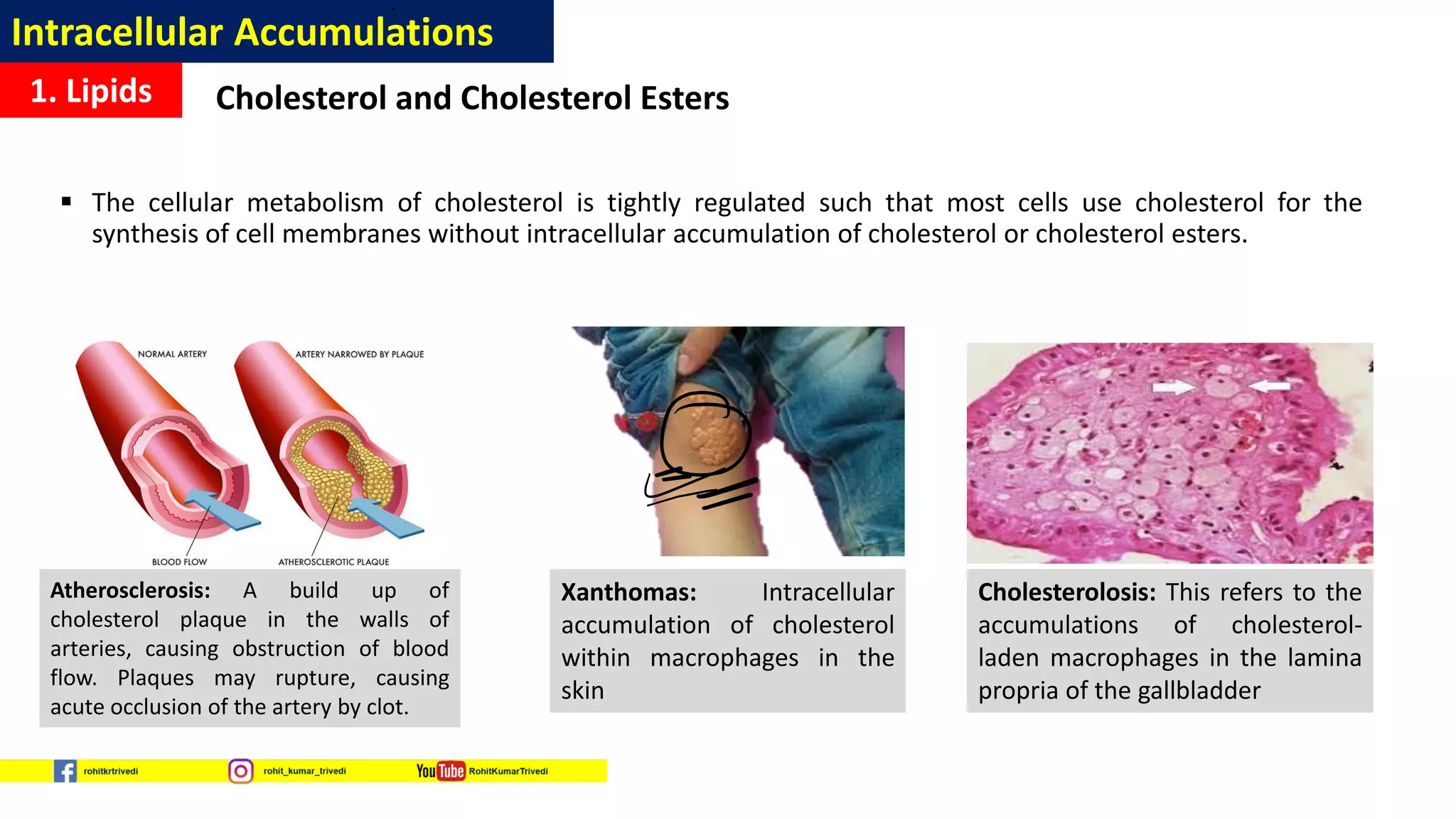 intracellular accumulation (lipids, proteins, carbohydrates, pigments ...