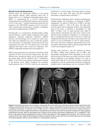 Liposarcoma: A Pictorial and Literature Review | PDF