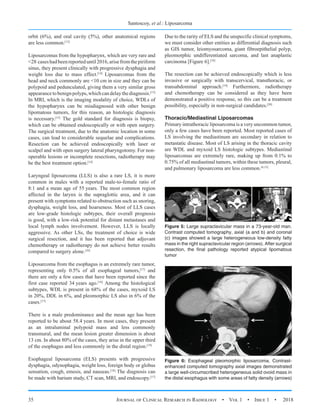 Liposarcoma: A Pictorial and Literature Review | PDF