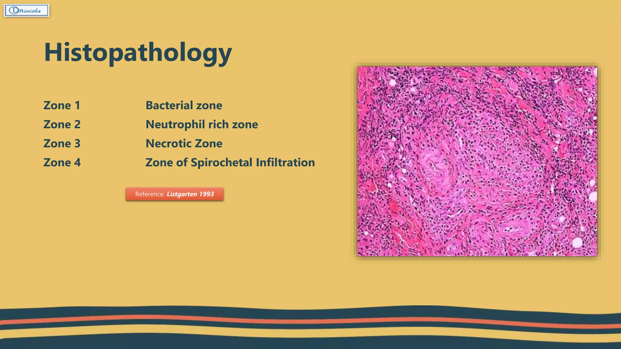 Acute Gingival Infections.pptx