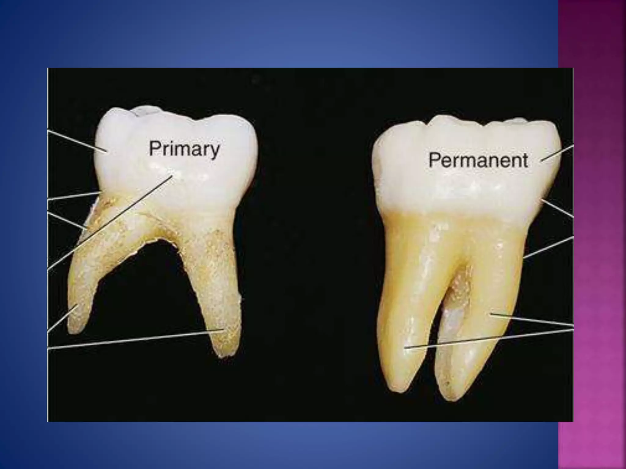 6. Diff bw primary and permanent dentition.pptx