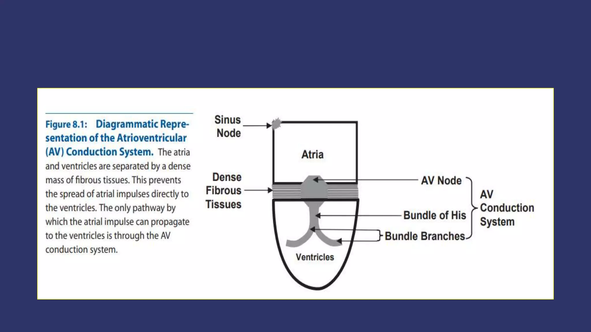 ATRIOVENTRICULAR BLOCKS.pptx