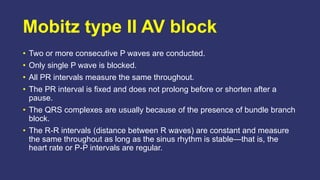 ATRIOVENTRICULAR BLOCKS.pptx