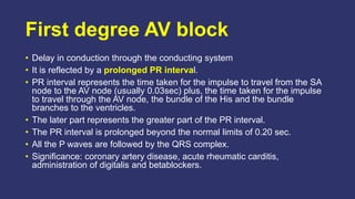 ATRIOVENTRICULAR BLOCKS.pptx