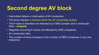 ATRIOVENTRICULAR BLOCKS.pptx