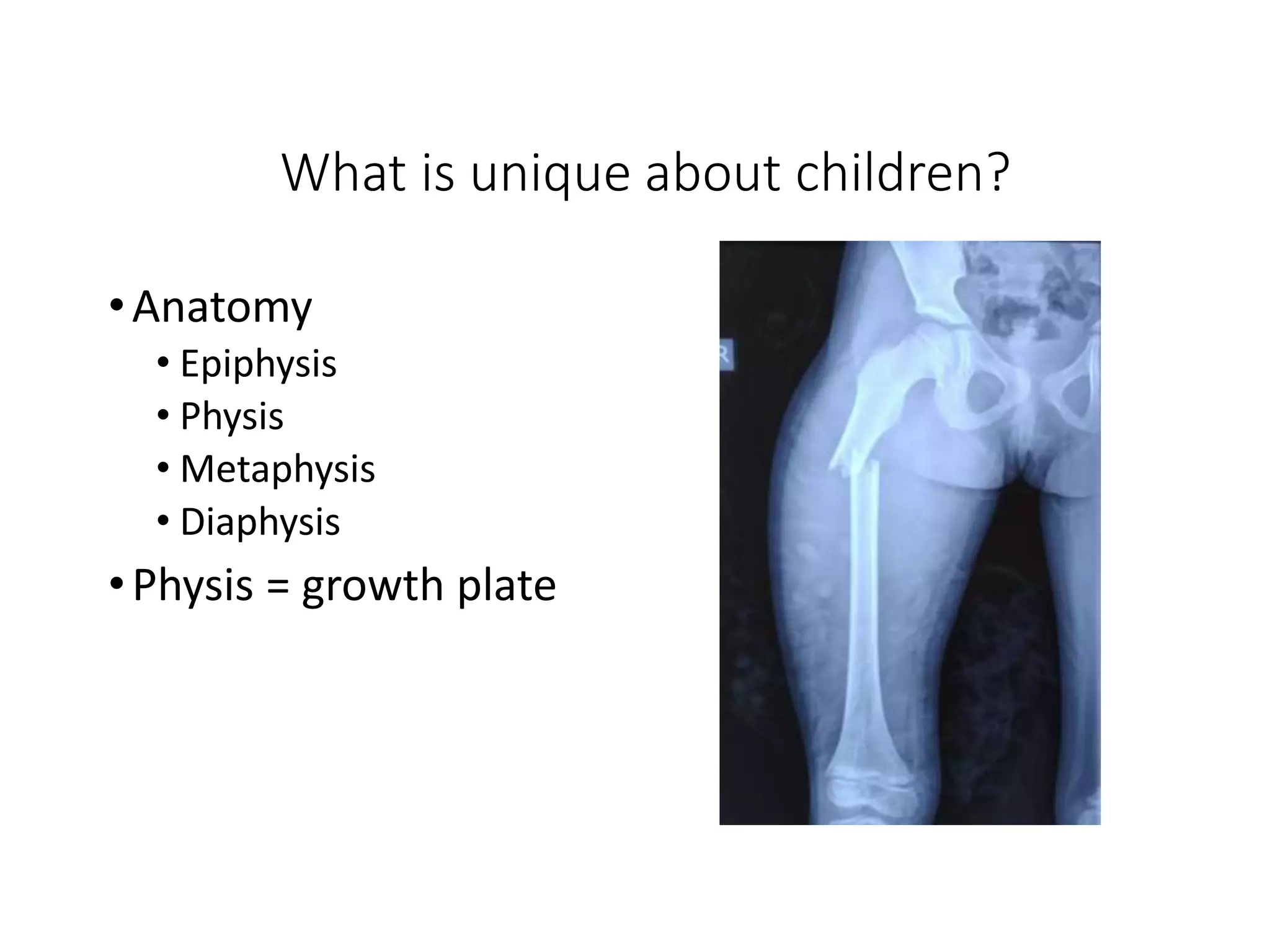 Fractures in children | PPT