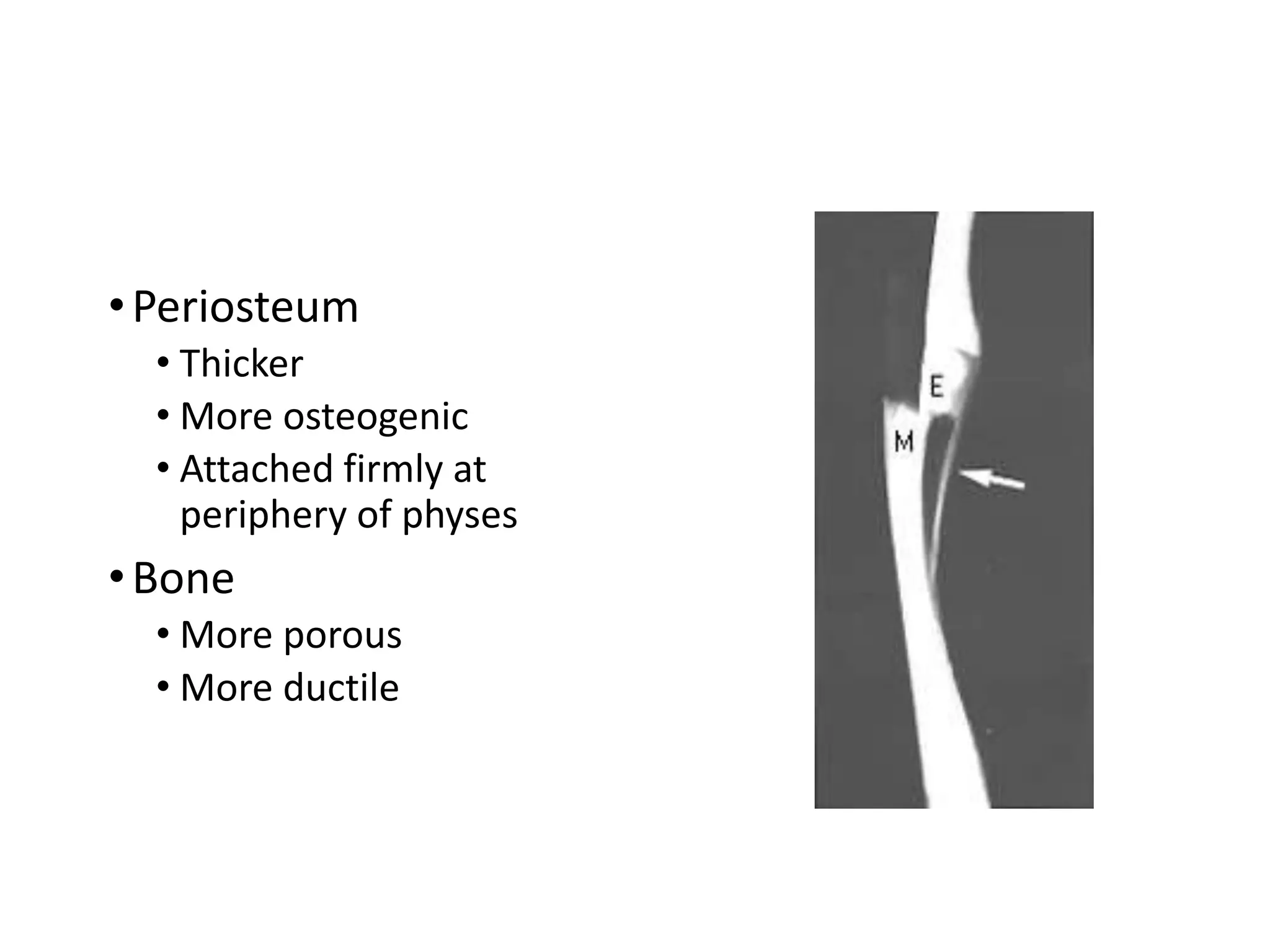 Fractures in children | PPT
