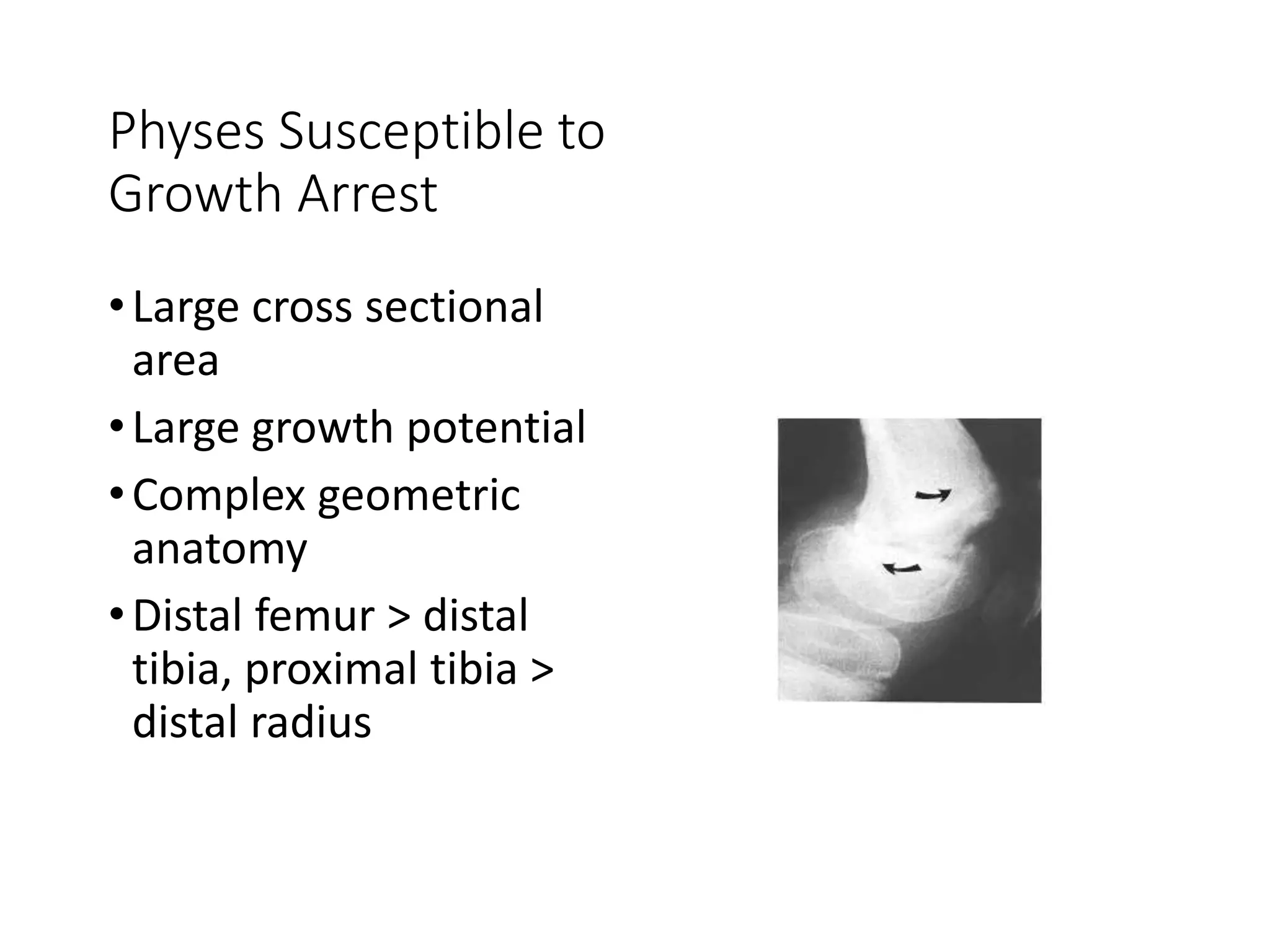 Fractures in children | PPT