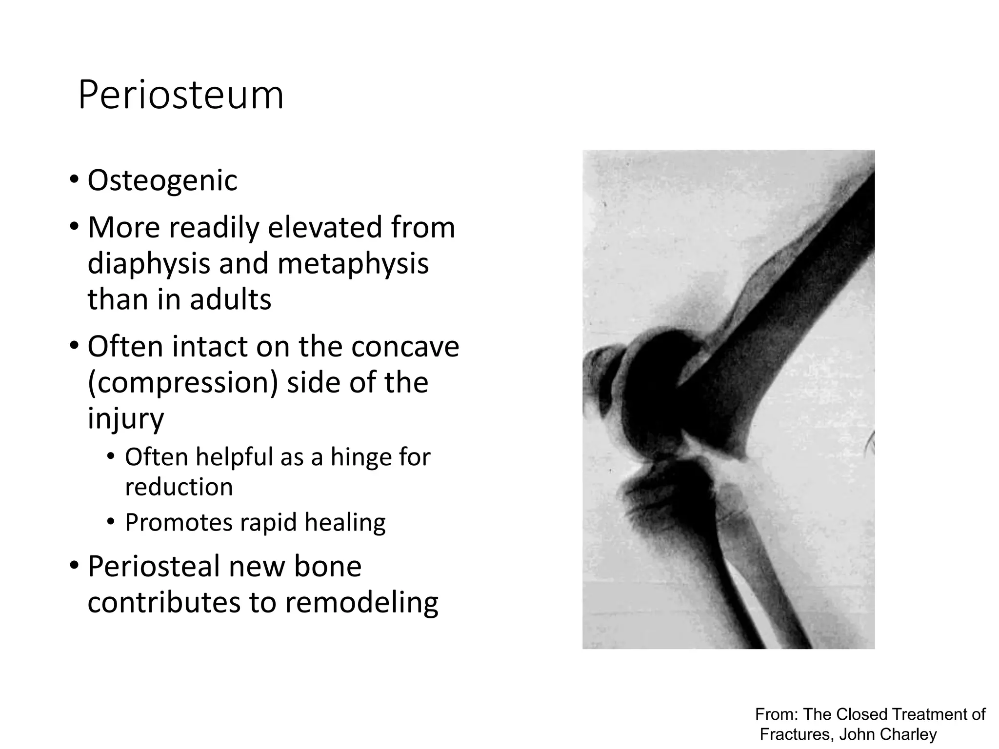 Fractures in children | PPT