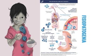 Enfermedad Inflamatoria Intestinal (CUCI y Crohn) y Otros. | PDF