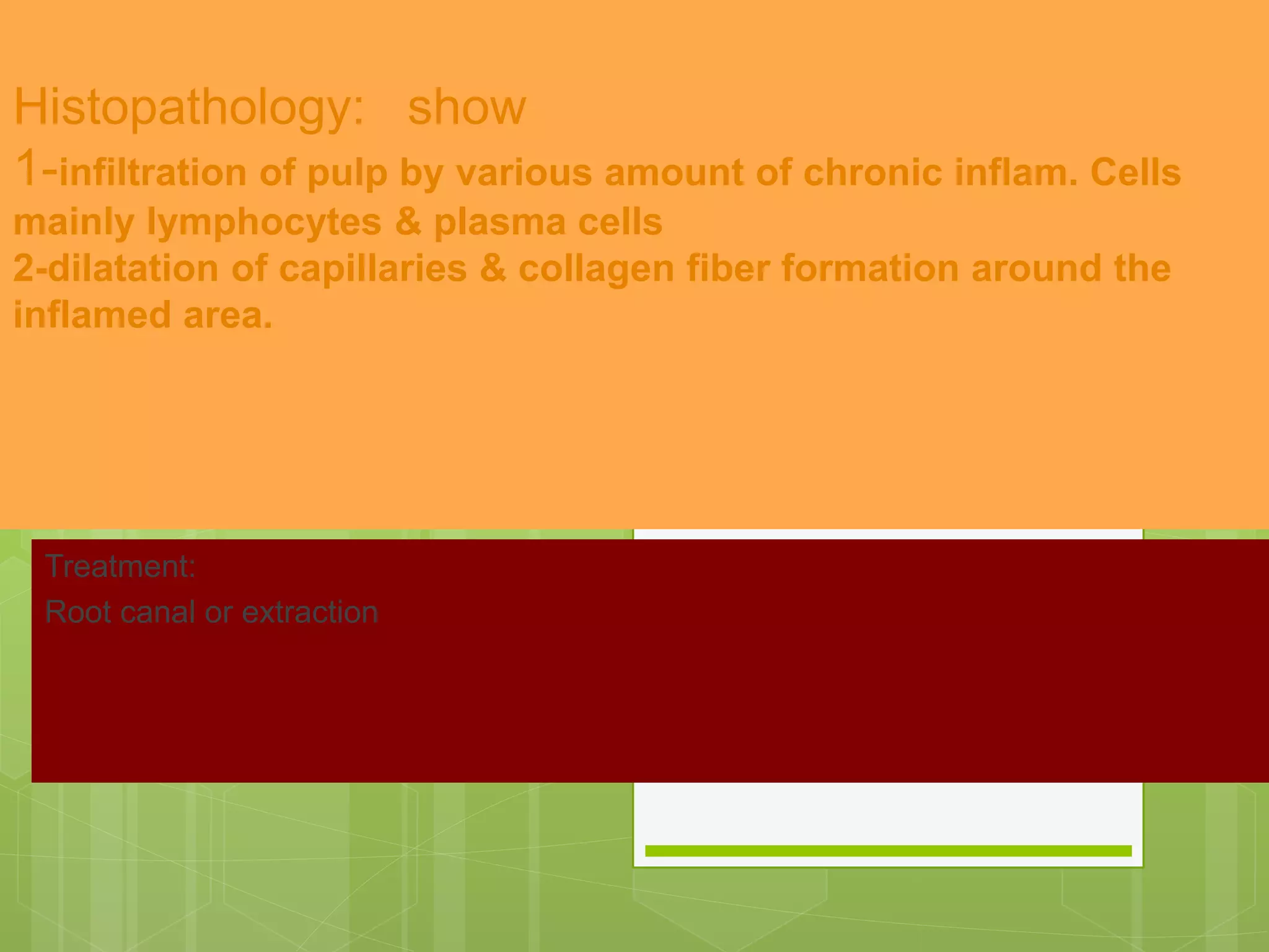 6.Pulp disease.ppt