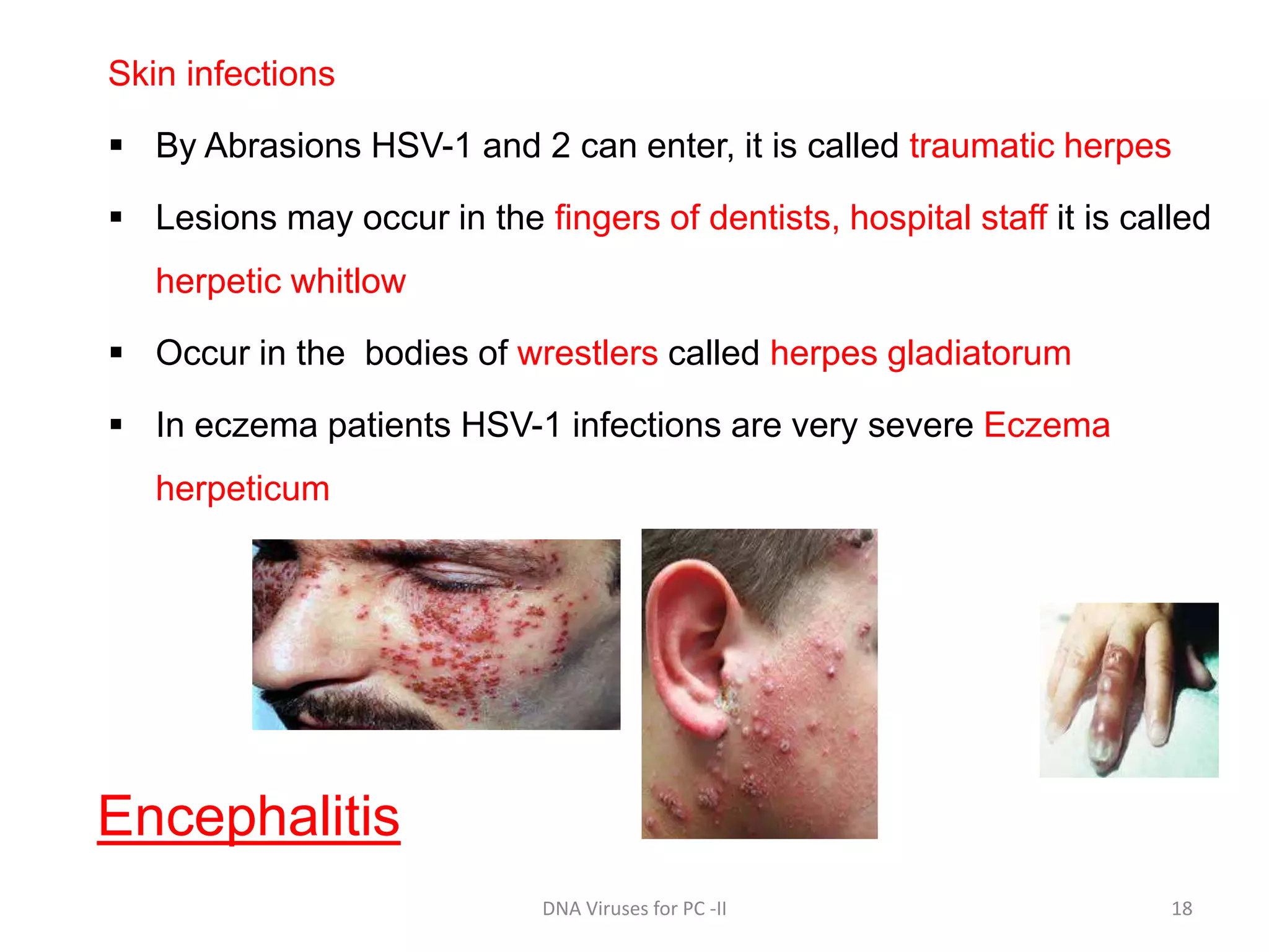 6. DNA& Herpes virus PH 2022.pptx