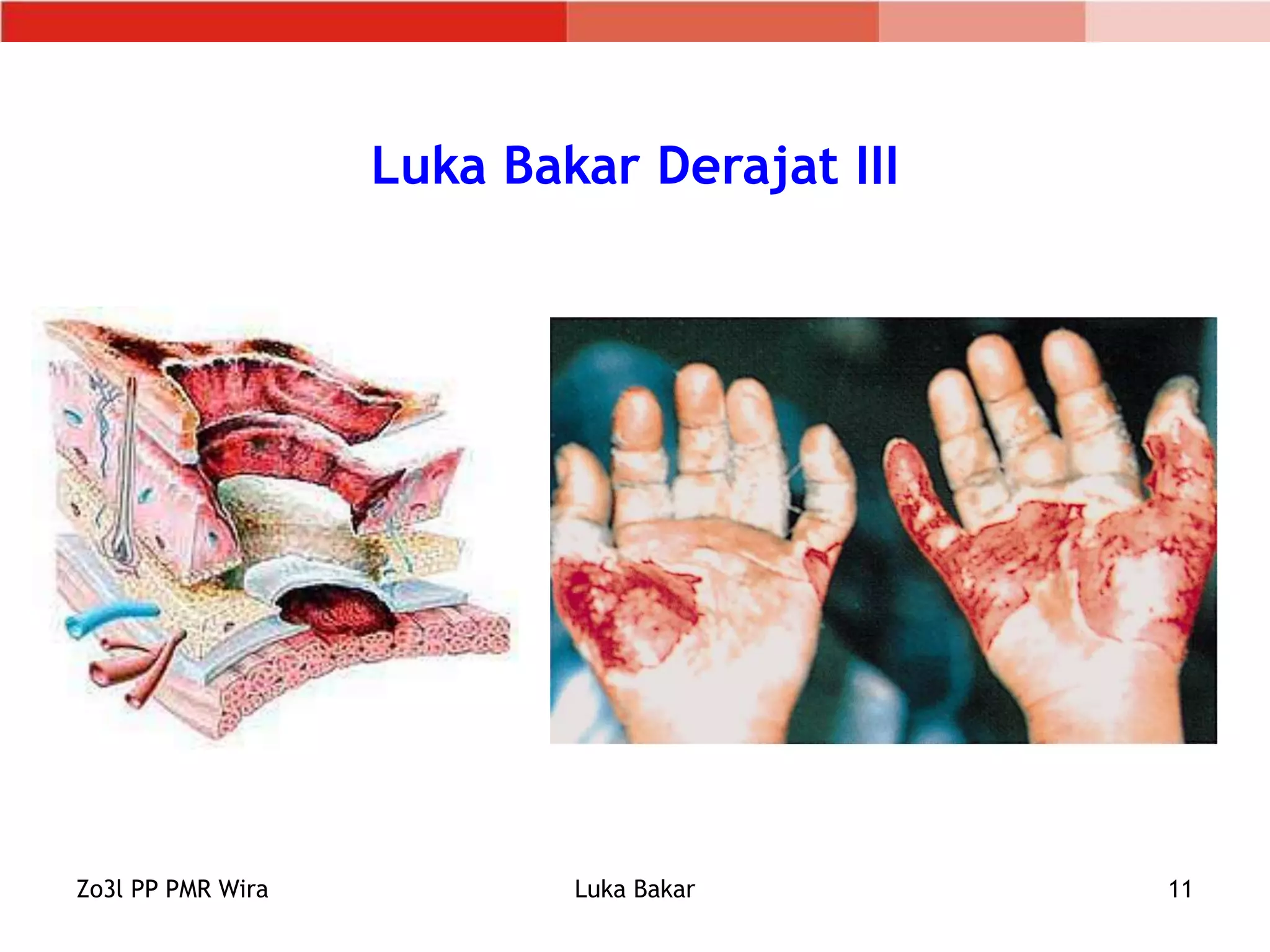 6. Luka Bakar.ppt