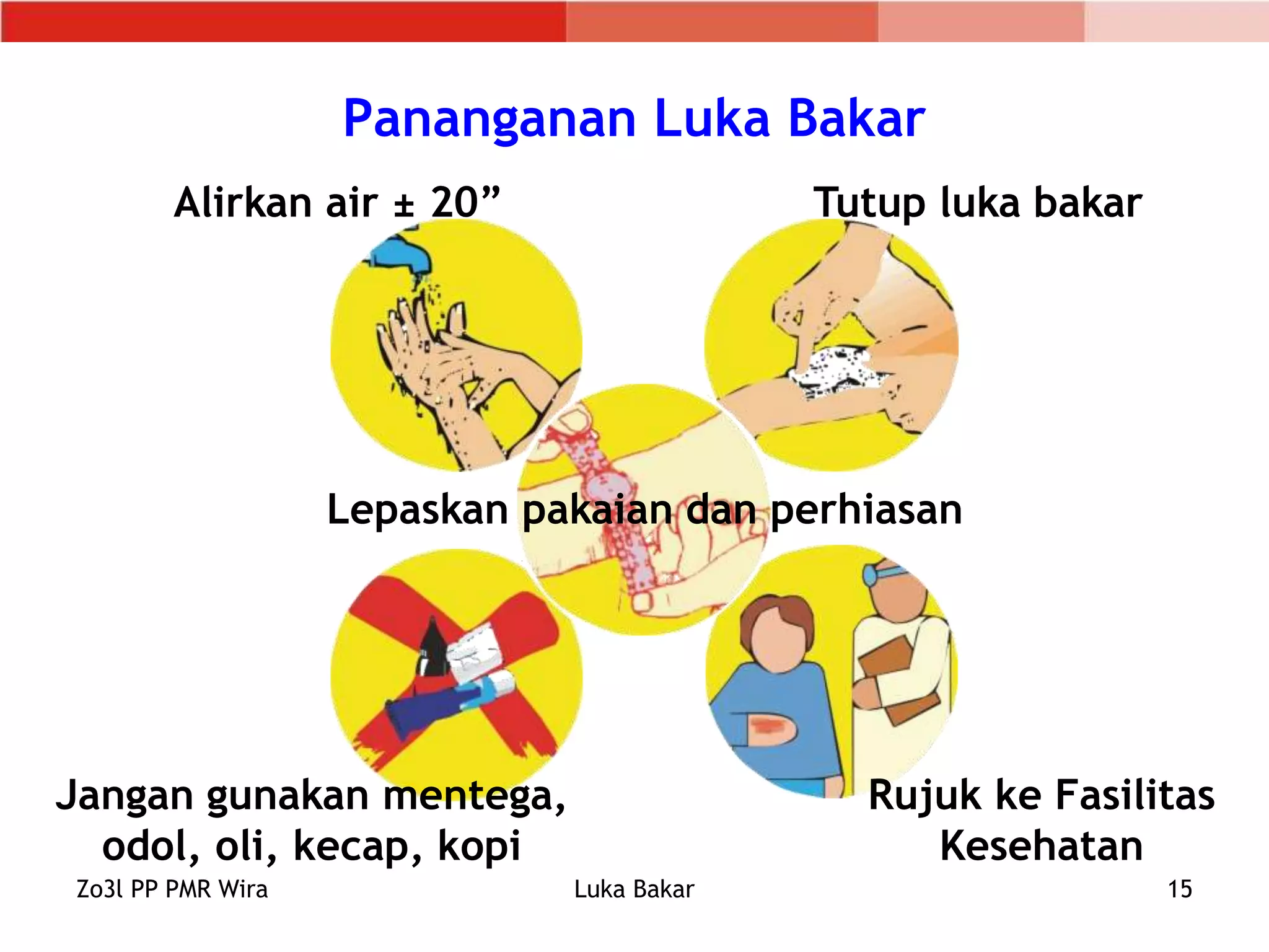 6. Luka Bakar.ppt
