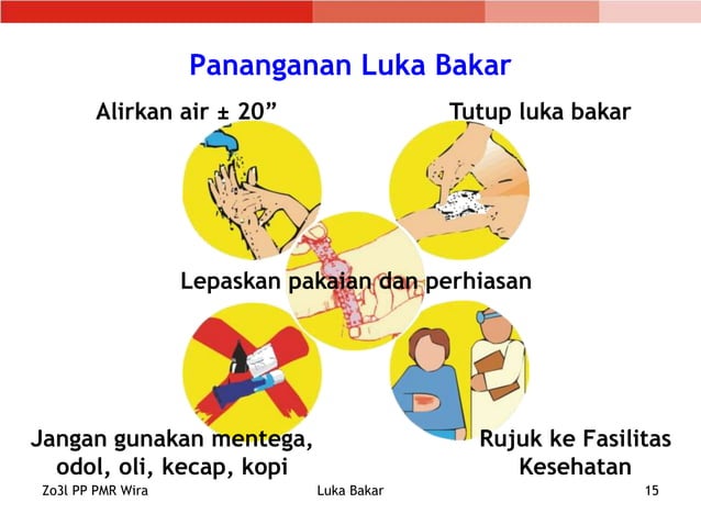 6. Luka Bakar.ppt