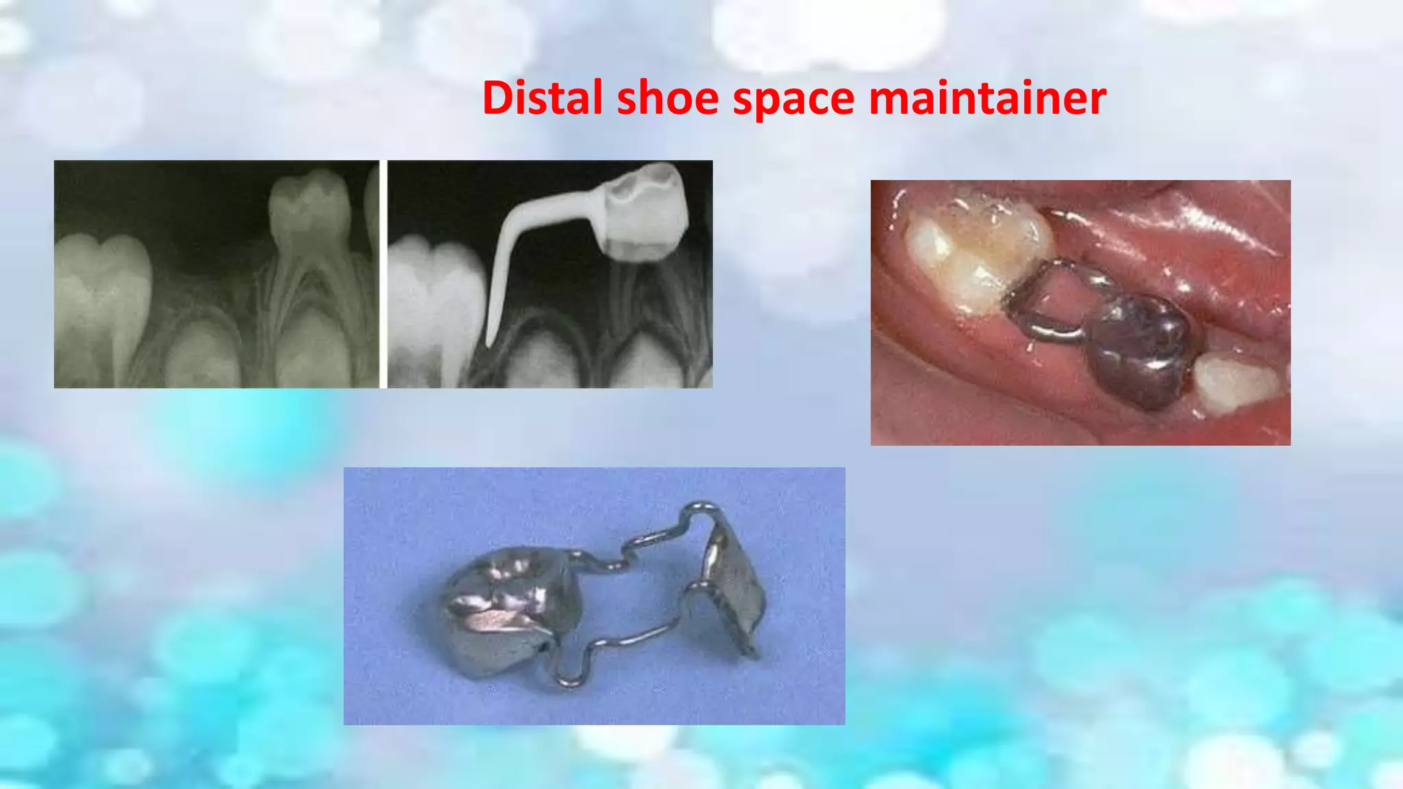 6.Dental factors affecting occlusal development .pptx | Dental Health ...