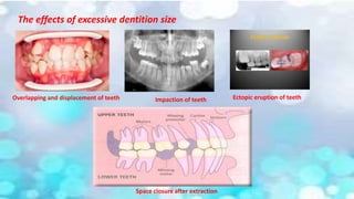 6.Dental factors affecting occlusal development .pptx | Dental Health ...
