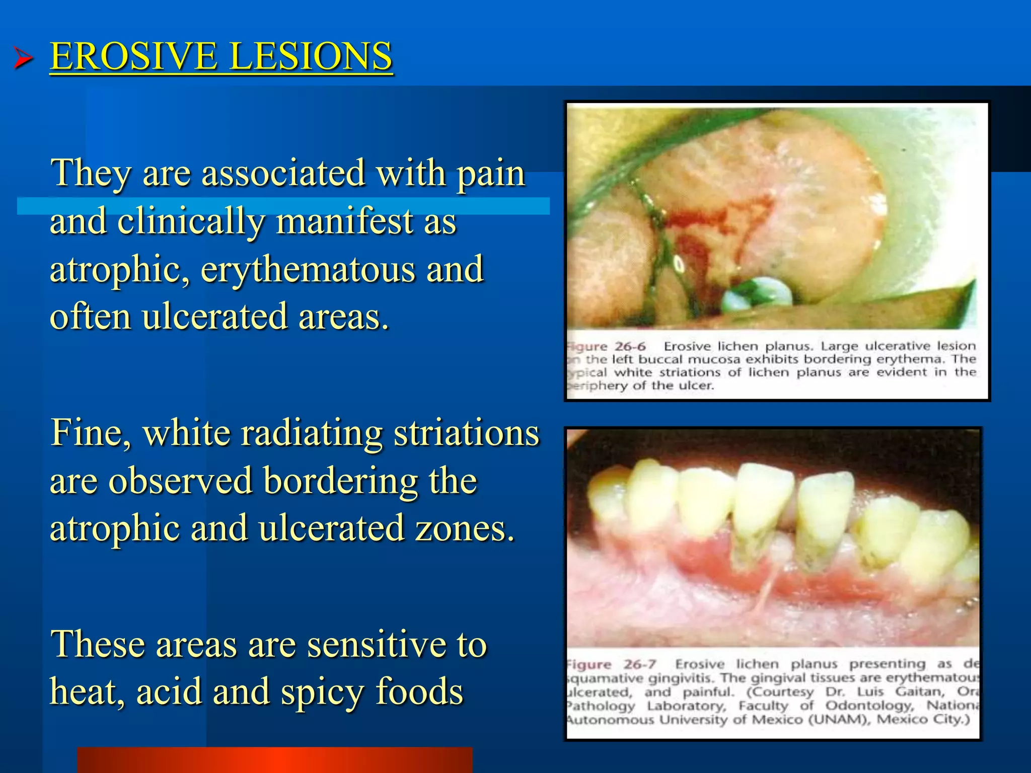 6.desquamative gingivitis.ppt
