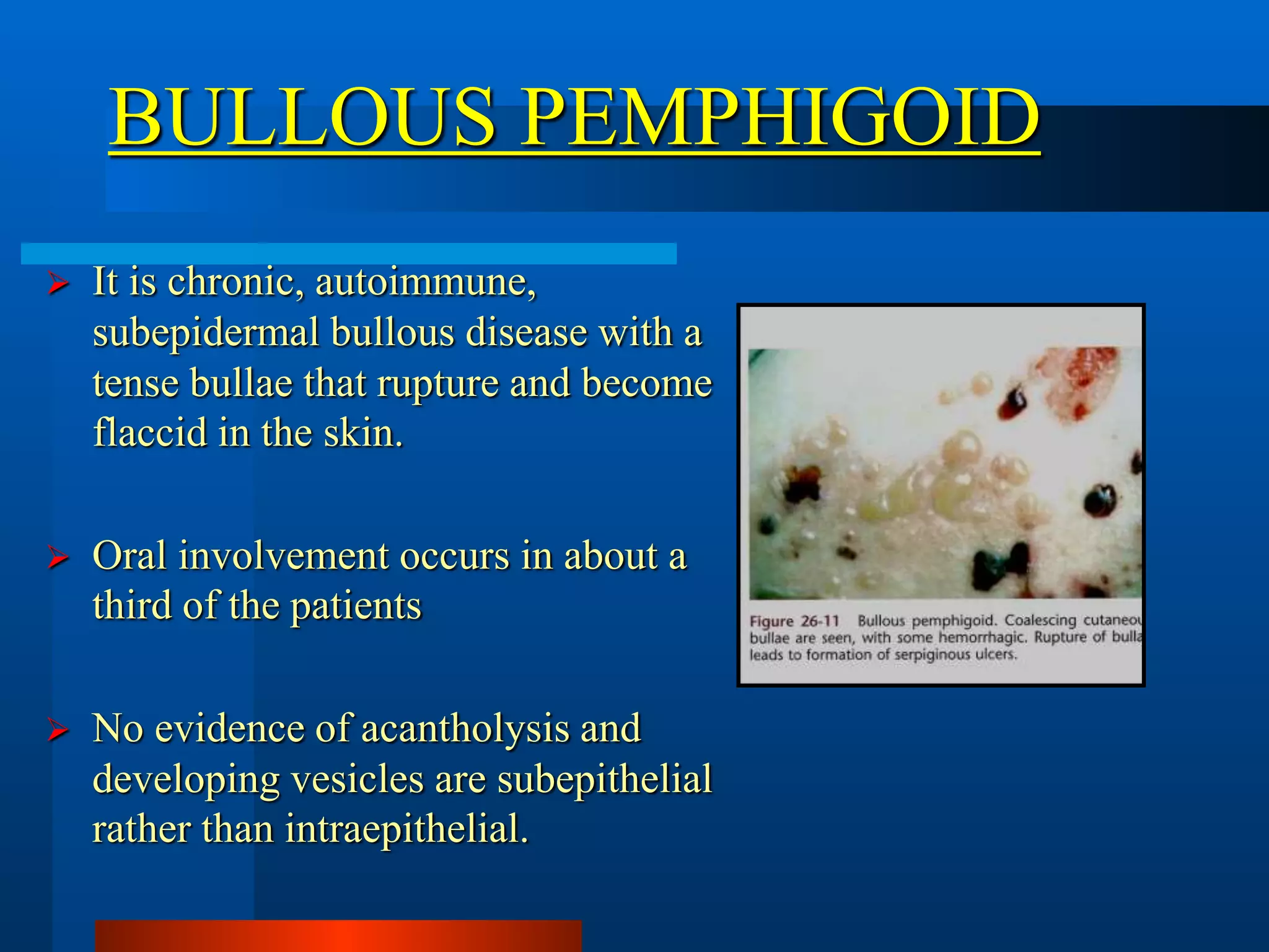 6.desquamative gingivitis.ppt
