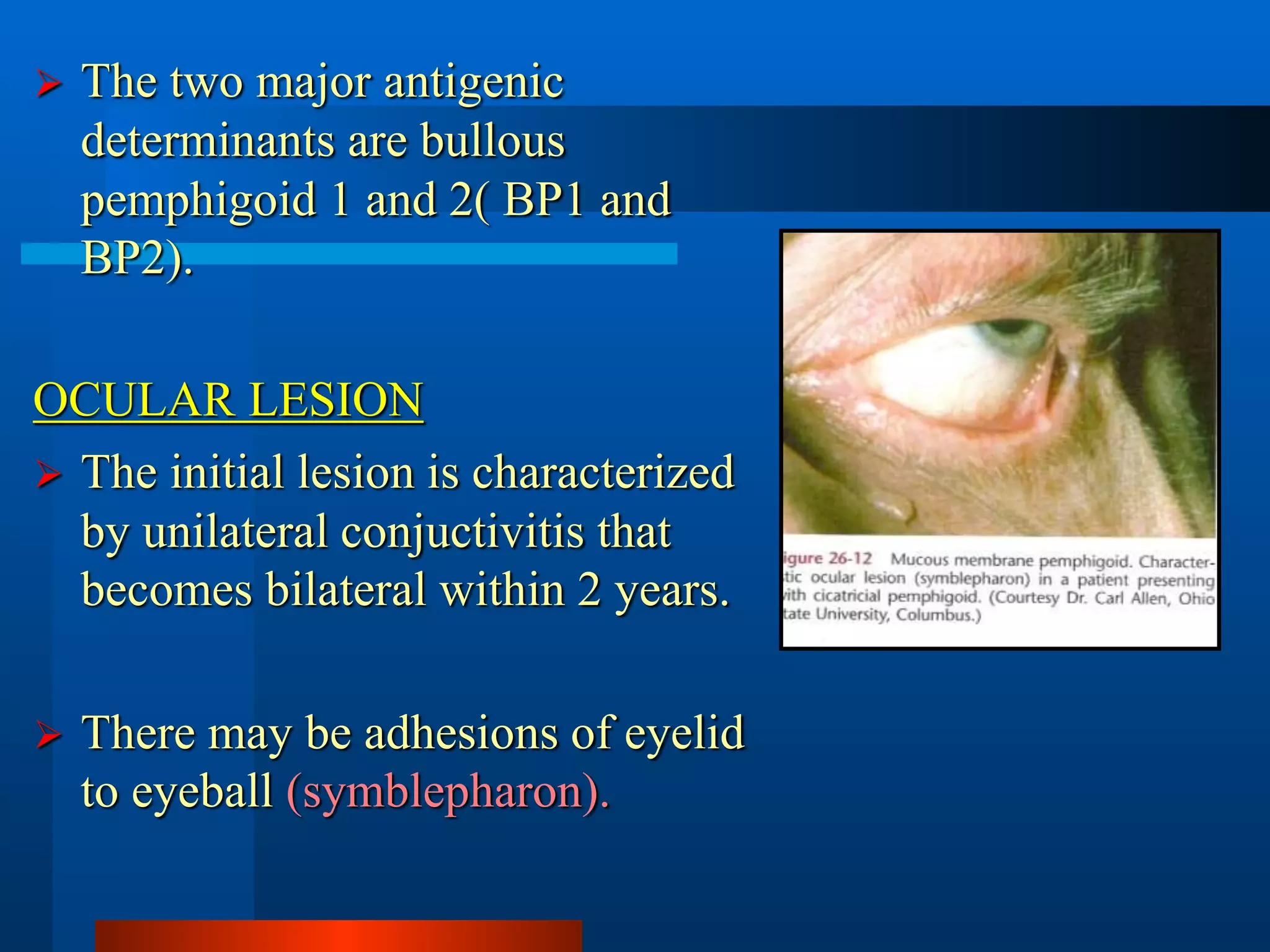 6.desquamative gingivitis.ppt