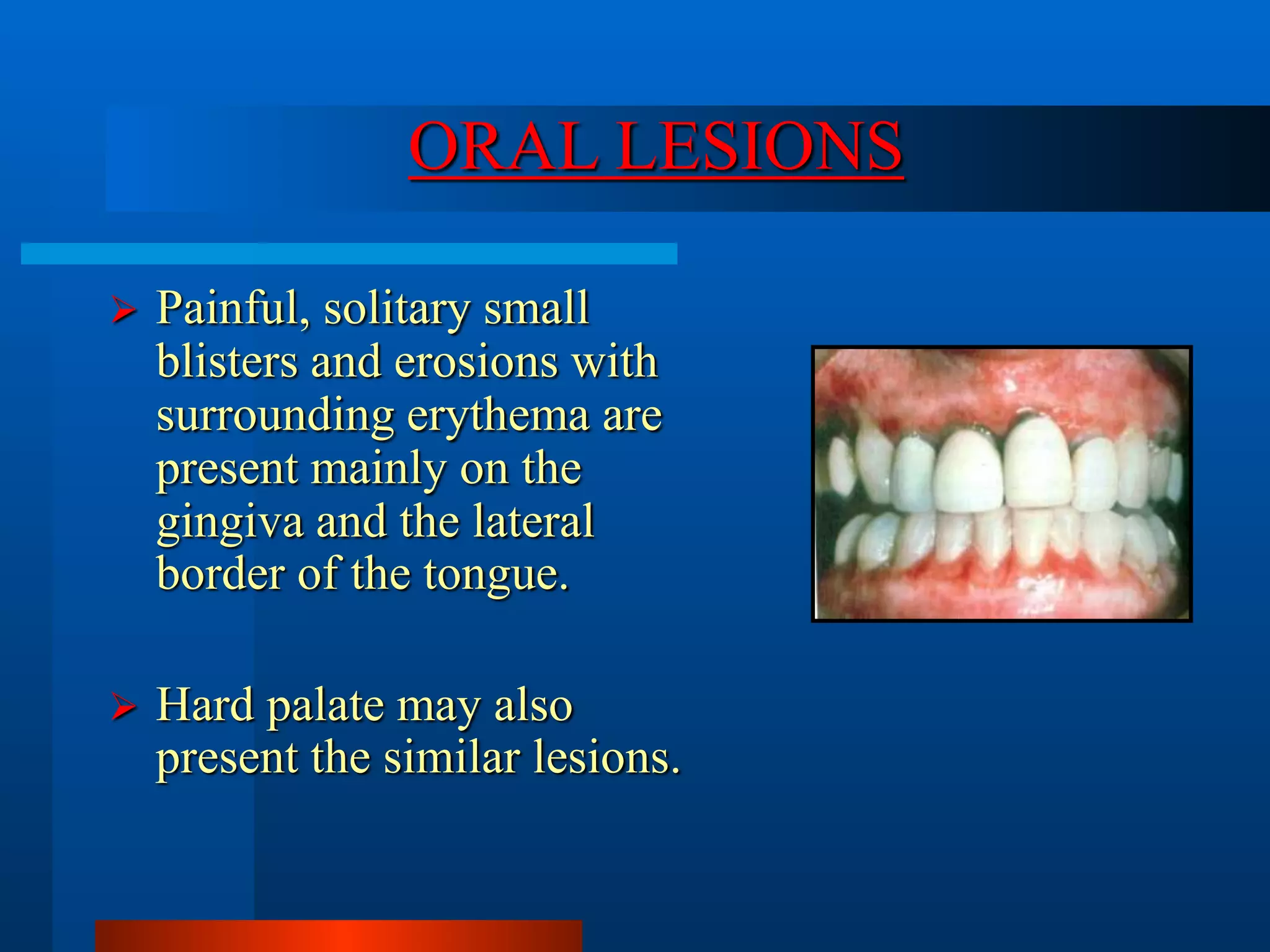 6.desquamative gingivitis.ppt