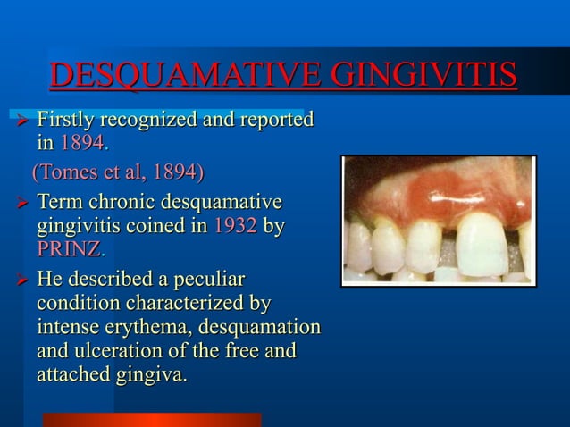 6.desquamative gingivitis.ppt