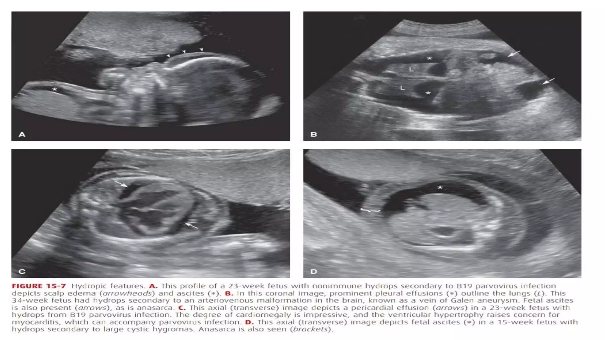 6. Fetal Disorders.pptx