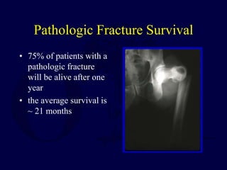 Pathologic Fractures orthopedics trauma | PPT