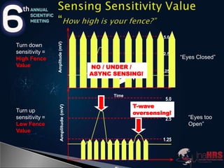 6. Tips and Trick PACING RHYTHM.pdf