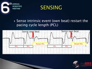 6. Tips and Trick PACING RHYTHM.pdf