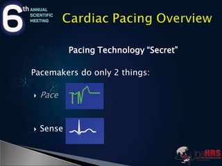 6. Tips and Trick PACING RHYTHM.pdf