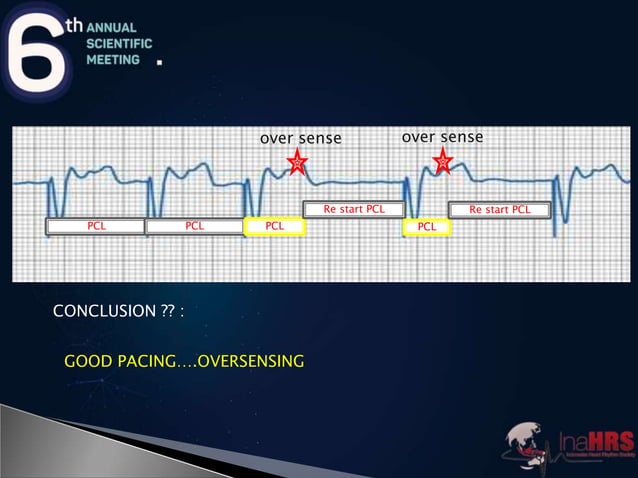 6. Tips and Trick PACING RHYTHM.pdf