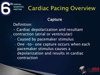 6. Tips and Trick PACING RHYTHM.pdf