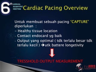 6. Tips and Trick PACING RHYTHM.pdf