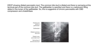 6. hepato biliary pancreatic.pptx