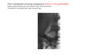 6. hepato biliary pancreatic.pptx