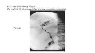 6. hepato biliary pancreatic.pptx