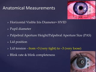 6. Pre-fitting Assessment of rgp lens.ppt