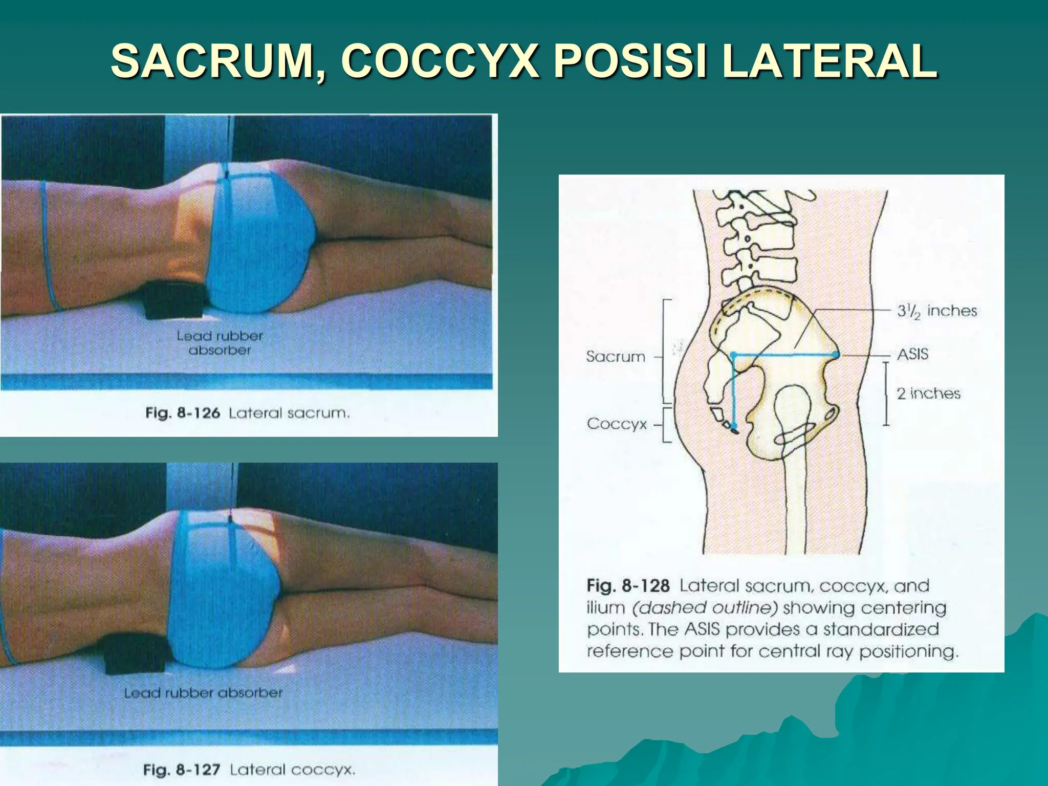 6. TR Sacrum dan coccyx-gs.ppt