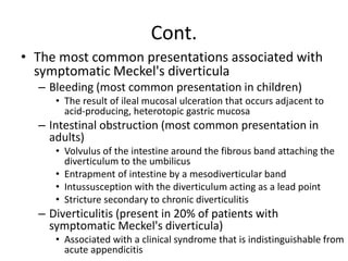 6.Meckel's Diverticulum.pptx
