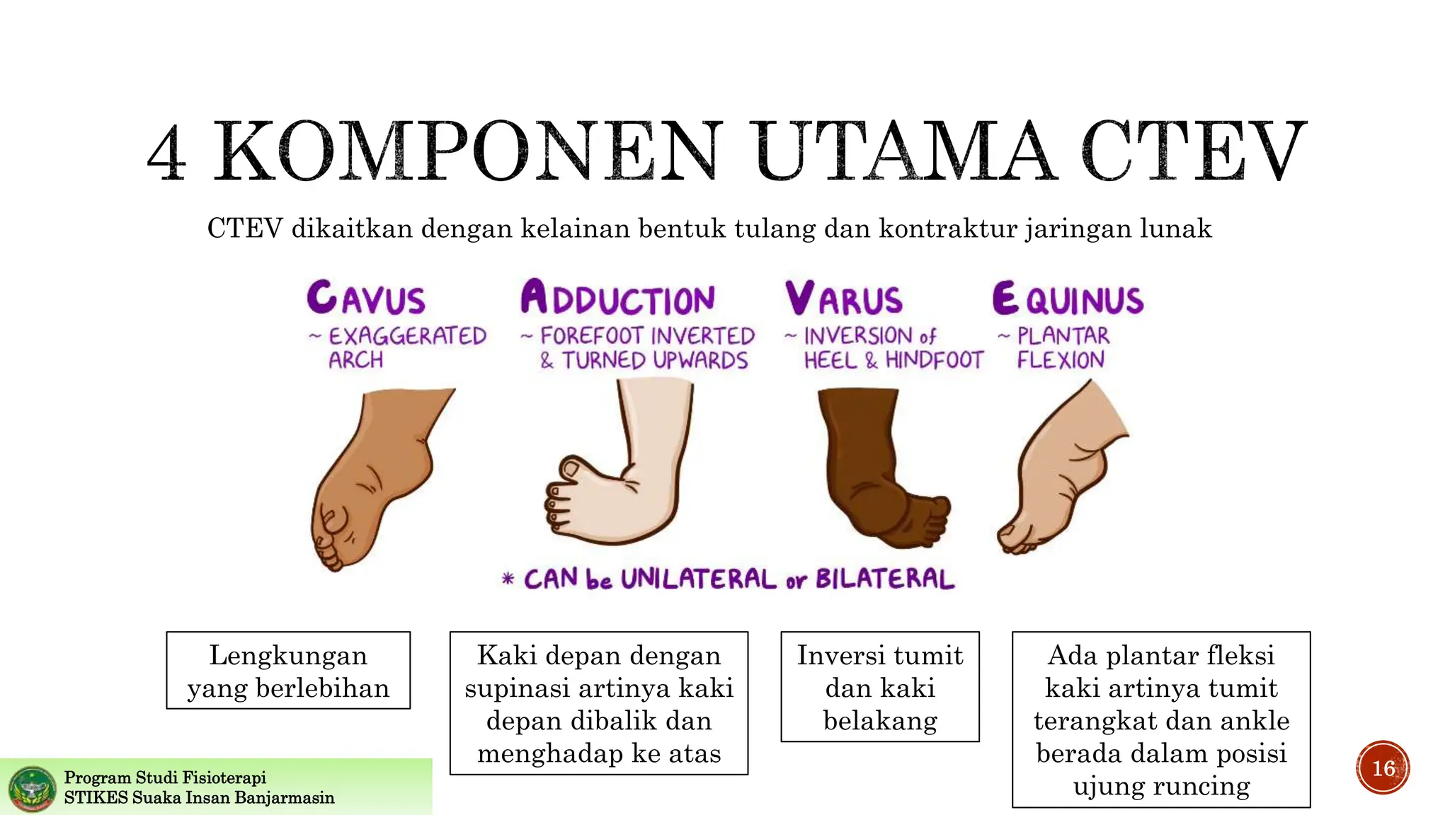 FISIOTERAPI PEDIATRI PADA KASUS - CTEV.pptx