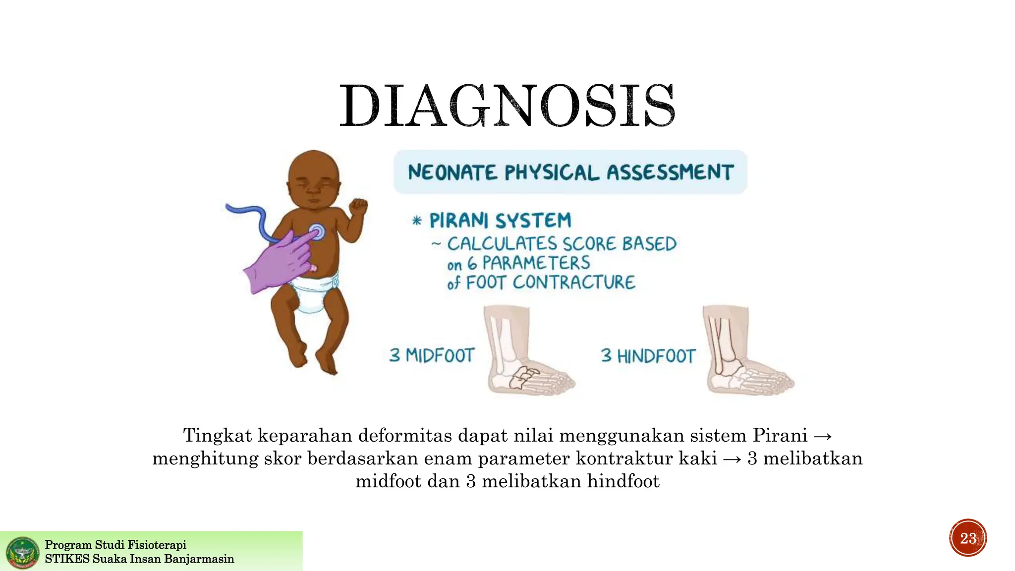 FISIOTERAPI PEDIATRI PADA KASUS - CTEV.pptx